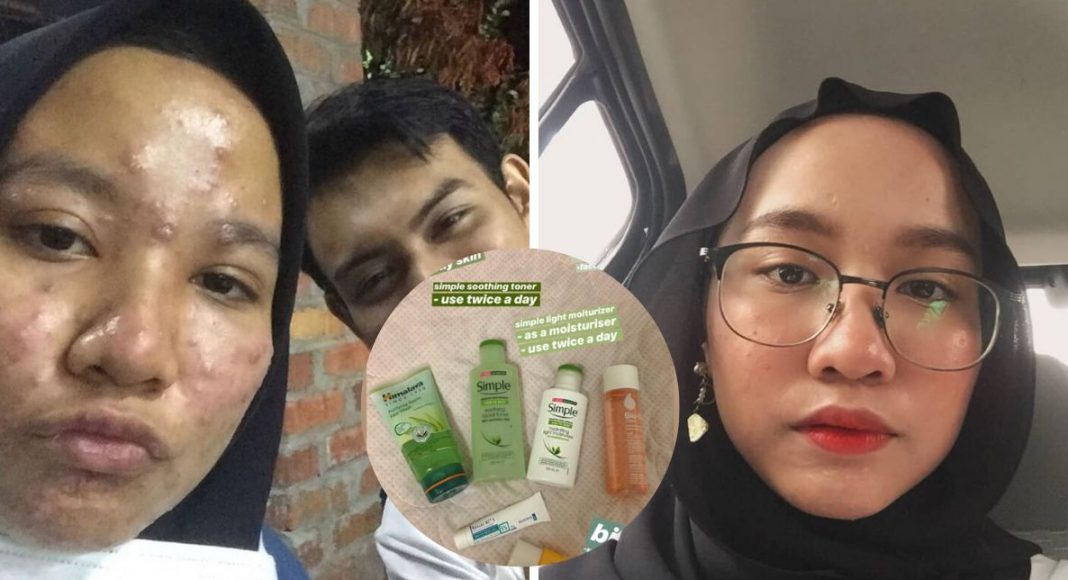 Spatula Makin Popular Gantikan Berus Mekap Dan Span, Tren K-Beauty Ini ...